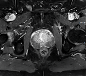 Magnetresonanztomografie (MRT) - Radiologie Zentrum Neu-Ulm • Günzburg